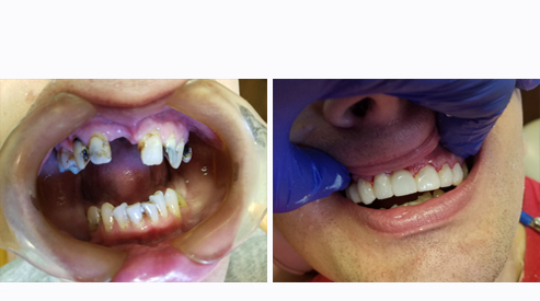 Xpert Dental | Cedarhurst Dentist | Alan Rosen DDS